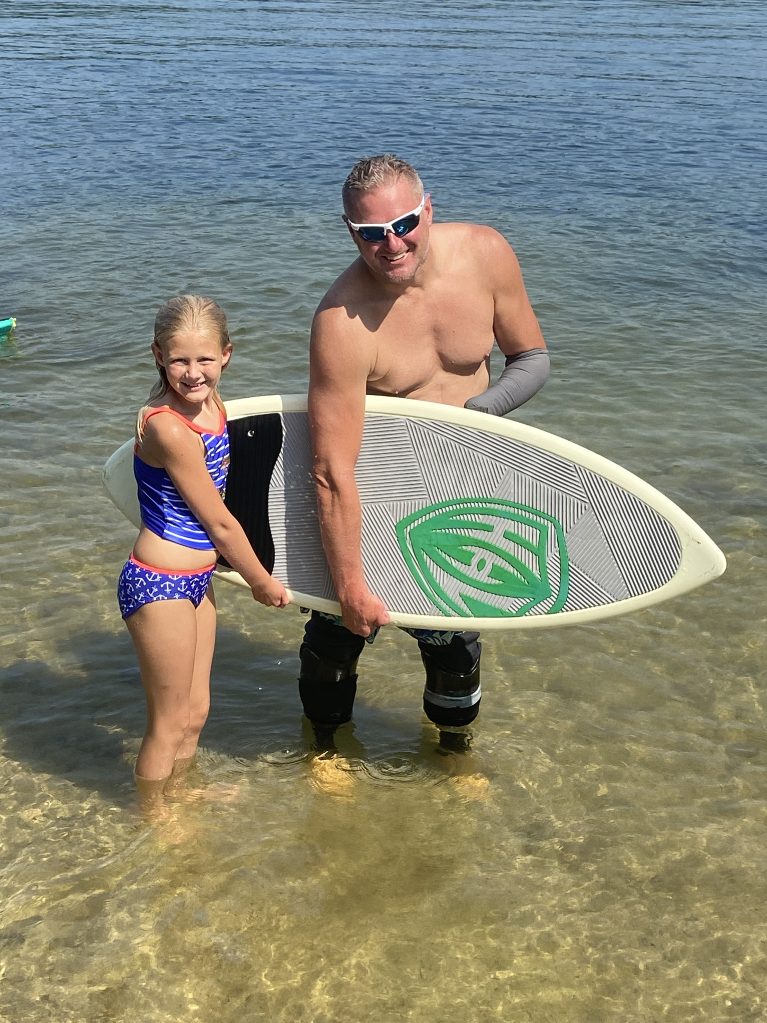 Hanger Clinic | 10 Tips for Supporting a Spouse Through Limb Loss and ...