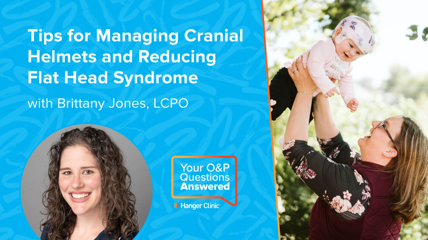 Hanger Clinic | Tips for Managing Cranial Helmets and Reducing Flat ...