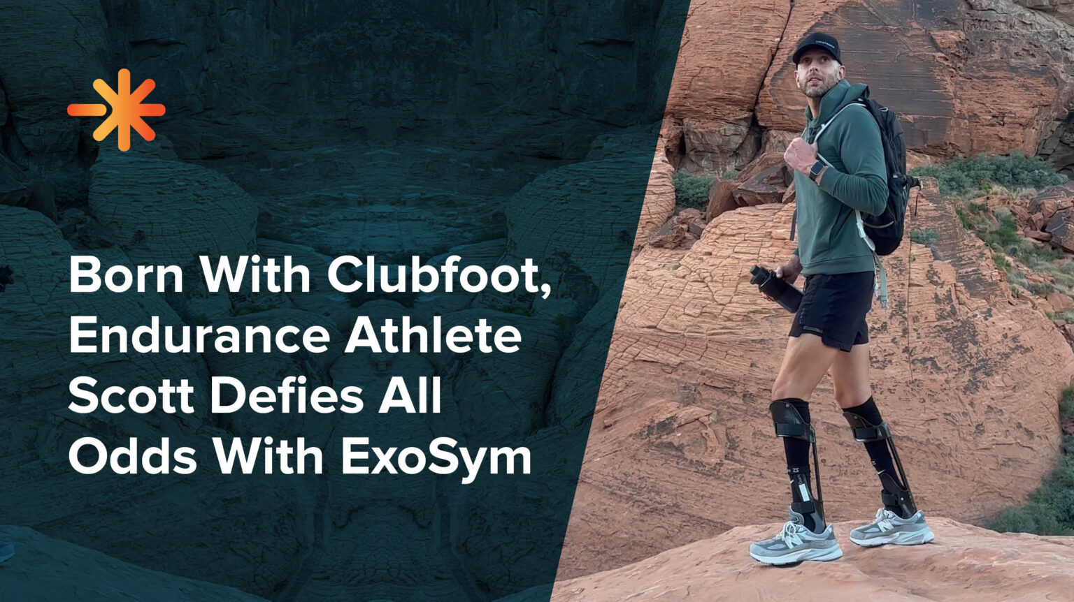 Hanger Clinic | Born With Clubfoot, Endurance Athlete Scott Defies All ...