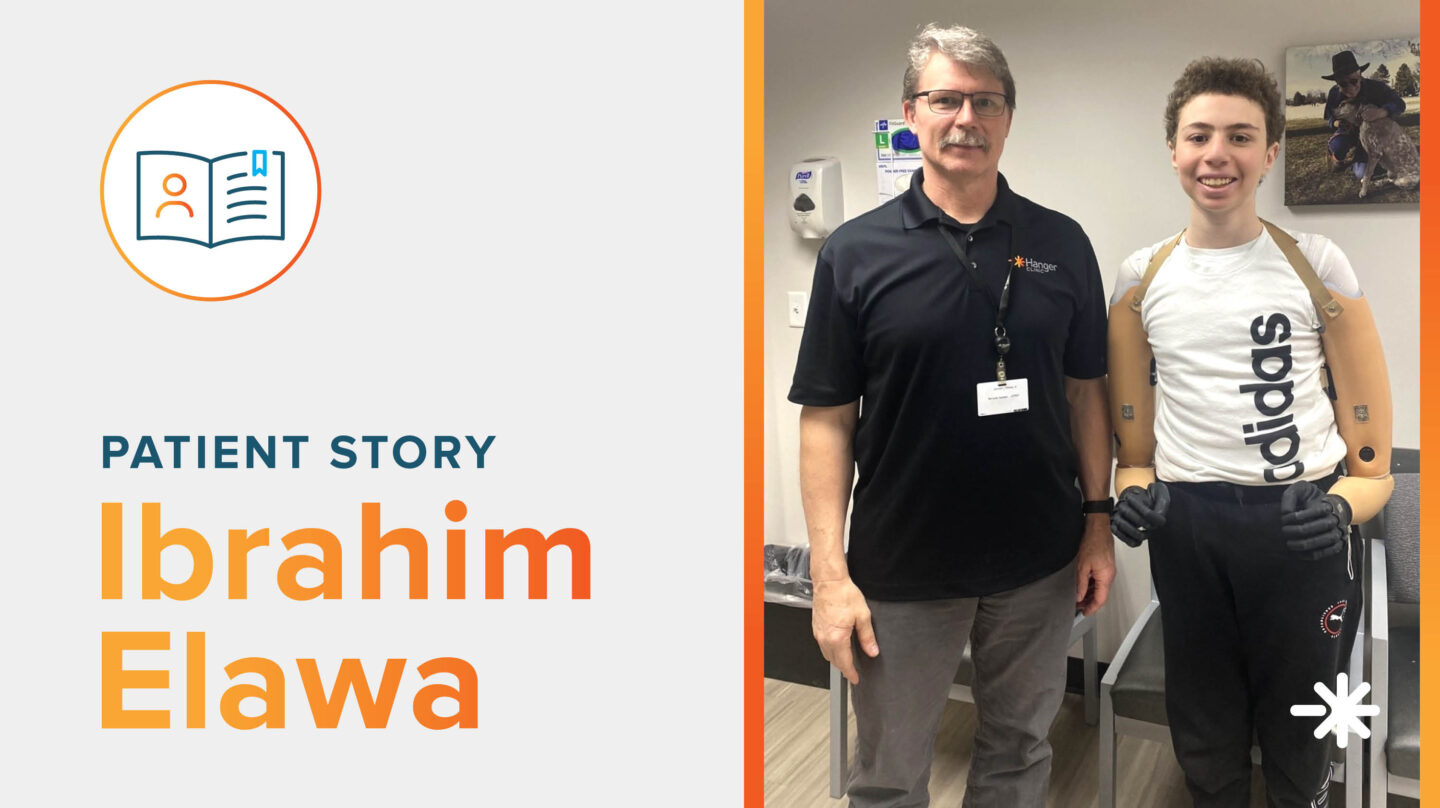 Prosthetic Hands & Hooks | Hanger Clinic