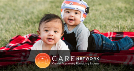 Cranial Remolding Orthosis | Hanger Clinic