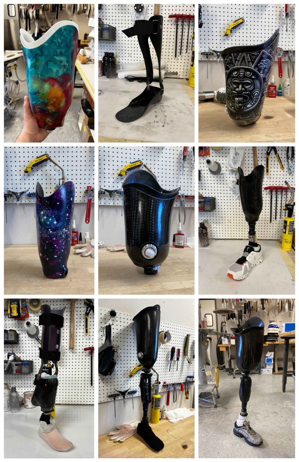 Orthotics & Prosthetics in Colorado Springs | Hanger Clinic