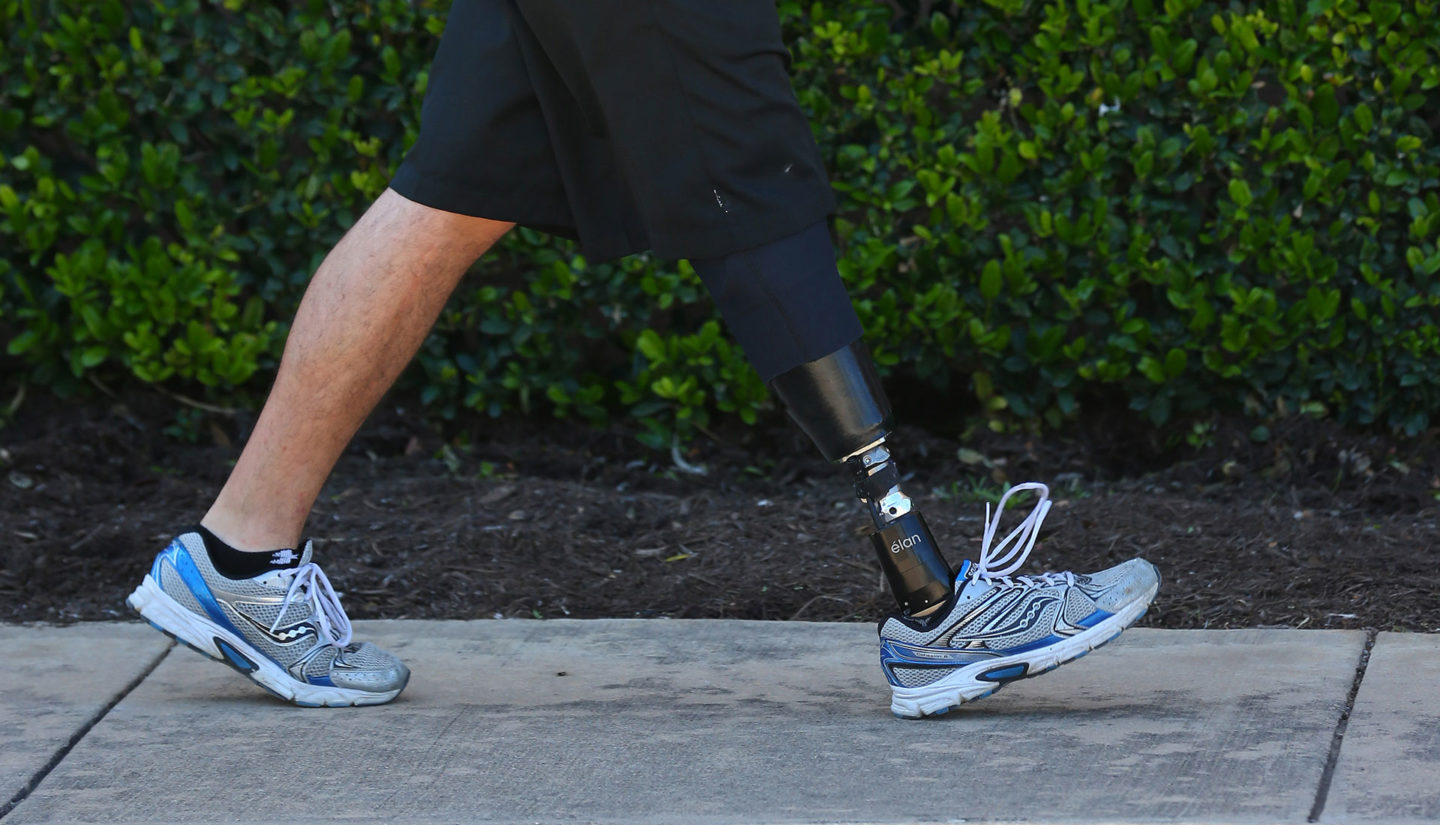 Lower Extremity Prosthetic Patient Education Clinic | Hanger Clinic